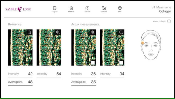 Cortex Aesthetic Software for DermaLab Aesthetic