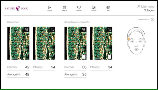 Cortex Aesthetic Software for DermaLab Aesthetic